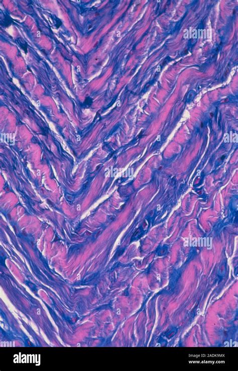 Fibrocartilage Light Micrograph Of Fibrocartilage This Type Of
