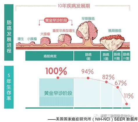怕肠镜足不出户防患于未然