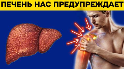 9 признаков того что в нашей печени содержится больше жира чем следует Игорь Ботоговский Дзен