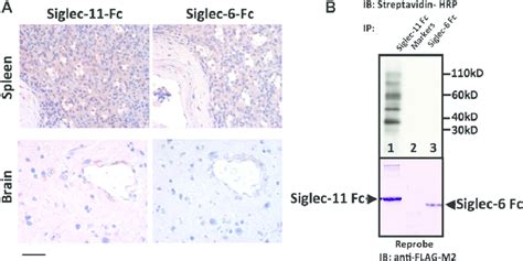Detection Of Siglec 11 Ligands In Human Brain A Sections Of Human Download Scientific