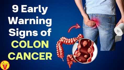 9 Signs And Symptoms Of Colon Cancer Colorectal Cancer Warning Signs Visitjoy Youtube