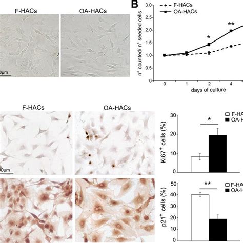 Morphology And Proliferation Rate Of Chondrocytes From Oa And Fractured
