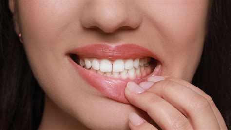 How Long Does It Take Gums To Heal After Implants