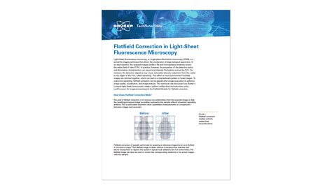 Flatfield Correction In Light Sheet Fluorescence Microscopy Bruker