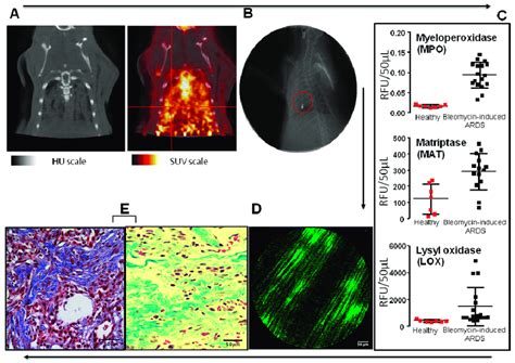 proposed multimodality testing imaging sequence in ards with