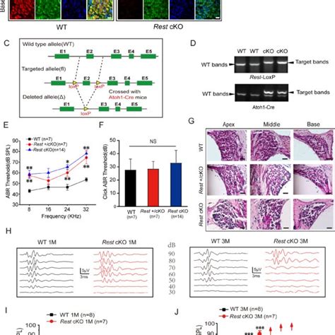 Repressor Element 1 Silencing Transcription Factor Rest Expression In Download Scientific