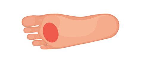 Under The Middle 3 Toe Joints Blisterhelp