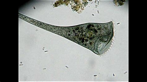 Pictures Of Stentor