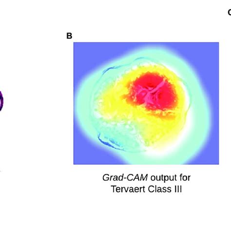 Incorporating Biological Interpretability A Input Glomerulus Image