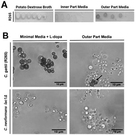Cryptococcus Neoformans Culture