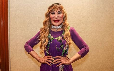 No Podrás Creer Cómo Lucía Lyn May Antes Del Procedimiento Estético Que Deformó Su Rostro Fotos