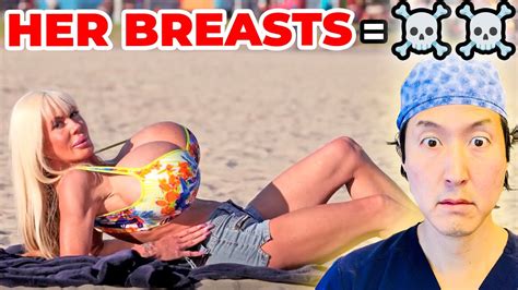 She Has The Largest Breasts Ever Extreme Bodies Explained Youtube