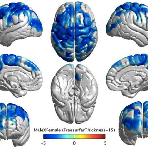 The Figure Above Shows The Cortical Thickness Map For A Group Download Scientific Diagram