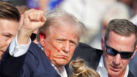 Trump Resulta Herido Leve En Un Intento De Asesinato Durante Un Mítin