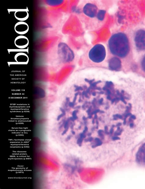 Clinical Significance Of Sf3b1 Mutations In Myelodysplastic Syndromes