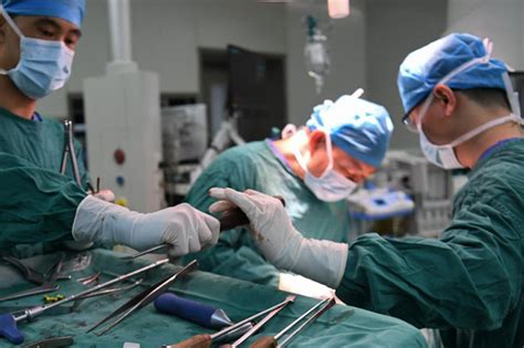 Ideal Shadowless Operating Lamp Features Blog Xyc Medical