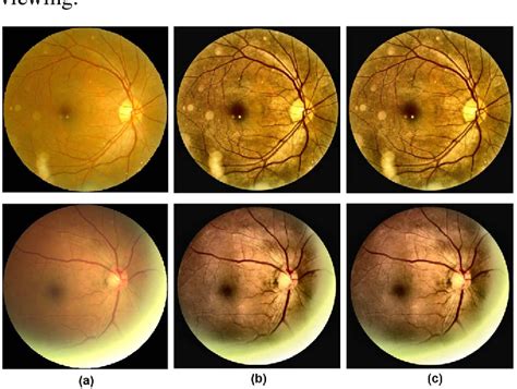 Figure 1 From Deep Neural Network Based Ensemble Model For Eye Diseases Detection And