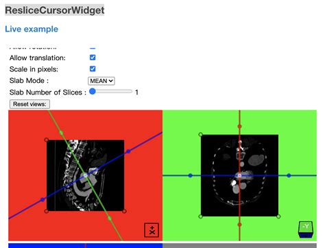 There Is A Problem With The Reset Views Function Of Reslicecursorwidget · Issue 2153 · Kitware