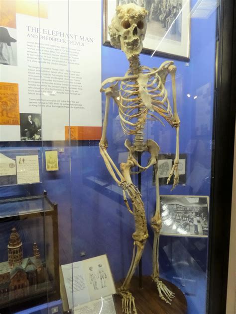 The Controversy Of Human Remains In Museums Last Posts