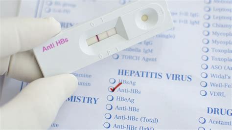 Hepatitis C Causes Symptoms And Treatment Spunout