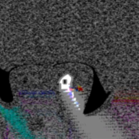 L̶̫͍̎͋́́͒͐͂̌͑̍͋̓̕͝͠ḯ̶̧̡̲͍̠̗̭͖̘̜̖͎͕̈́́͆̈́̃̔̈́̒̈̋̄͆̕