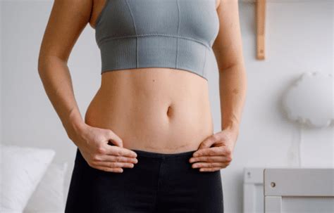 C Section Pouch Causes Treatment And Prevention Centre For Surgery