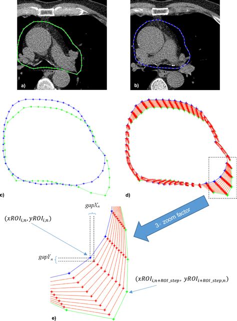 Figure 3 From A Semi Automatic Approach For Epicardial Adipose Tissue Segmentation And
