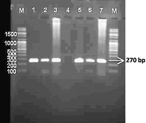 An Amplicon Size Of 270bp Produced From The DNA Extracted By High Salt Download Scientific