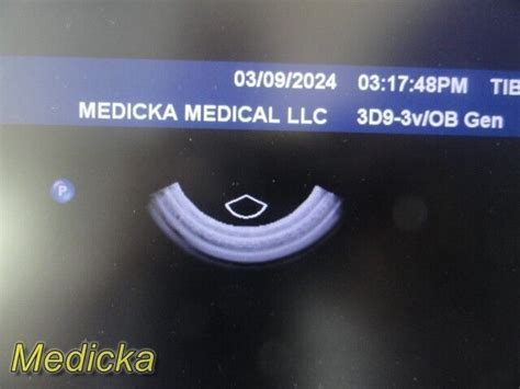 Used Philips 3d9 3v Convex Array 3d Endocavity Ultrasound Transducer For Sale Dotmed Listing