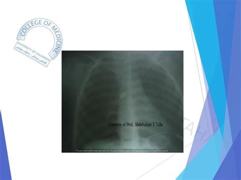 Bead In Right Main Stem Bronchus Pdf