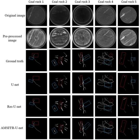 The Fracture Segmentation Results Of Three Networks On Five Different