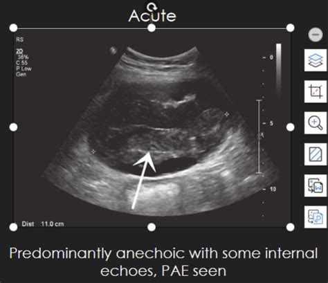 Soft Tissue Pathology Flashcards Quizlet