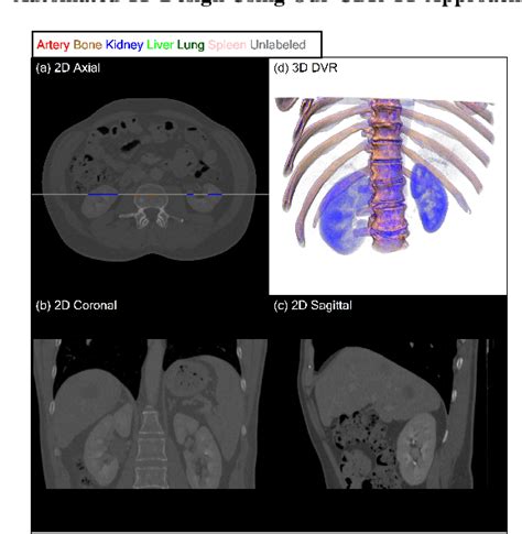 Figure 1 From A Transfer Function Design Using A Knowledge Database Based On Deep Image And