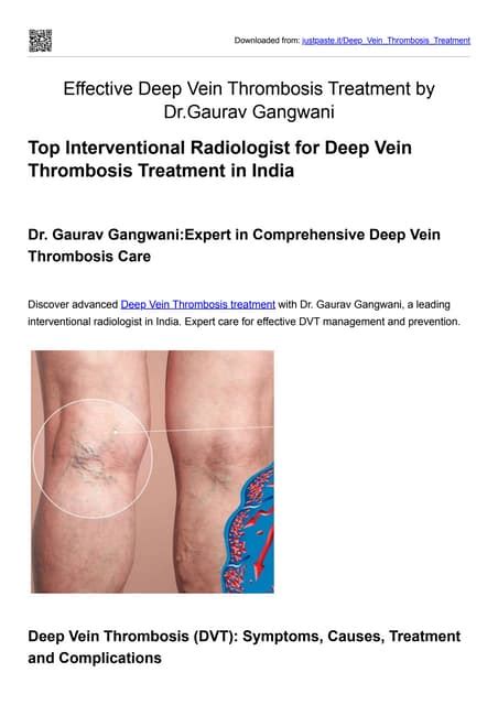 Effective Deep Vein Thrombosis Treatment By Drgaurav Gangwani Pdf