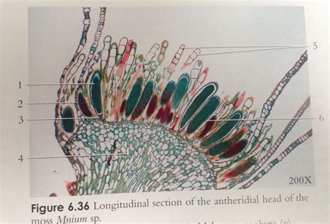 2 4 Labeled Bryophytes Longitudinal Section Of The Antheridial Head Of Mnium Bio Lab 3
