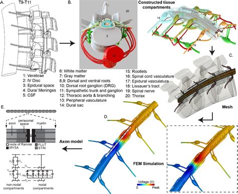 Subarachnoid Space Spinal Cord Model