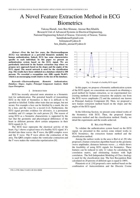 Pdf A Novel Feature Extraction Method In Ecg Biometrics