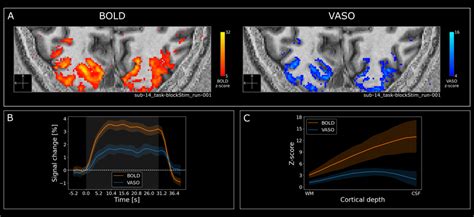 Block Wise Stimulation Results Show Robust Activation A Glm Activation Download Scientific