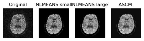 Denoise Images Using Adaptive Soft Coefficient Matching Ascm — Dipy 1
