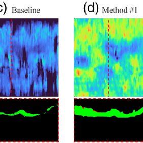 Segmentation Results Of OCT B Scan Are In Normal Control Site Of Download Scientific Diagram