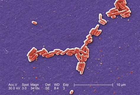 Free Picture Magnification 3418x Colorized Micrograph Gram