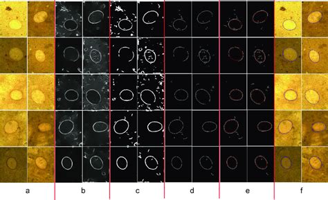 The Process Of Cascaded Automatic Segmentation A The Original Images