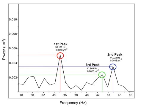 Determination Of The Three Highest Gamma Peaks For Calculating The Download Scientific Diagram