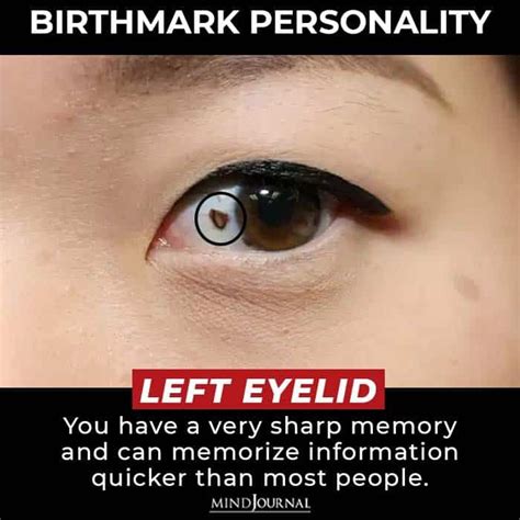 Birthmark Meanings What Does Your Birthmark Say About You Artofit