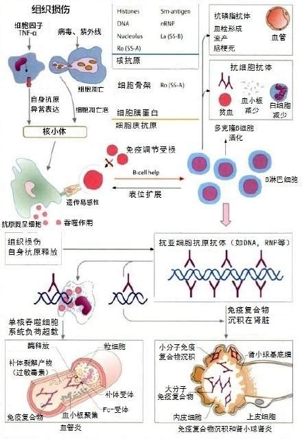 干货 收藏：一图知晓红斑狼疮发病机制