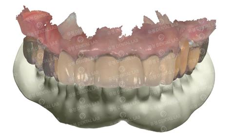 유정치과 기공소 Yujong Korea • Instagram Photos And Videos