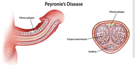 Reproductive Systems Flashcards Quizlet