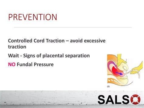 Uterine Inversion 2018 Pptx
