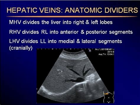 Us Hepatobiliary System Technique And Us In Hepatobiliary