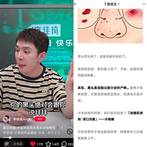 鼻子上的黑头能去掉吗？有什么好的解决办法？ 知乎